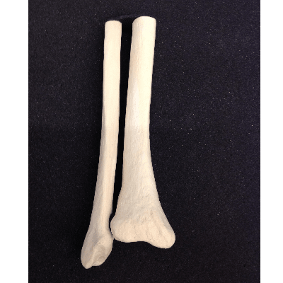 Sawbone Ankle for Plating