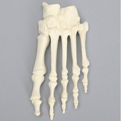 Sawbone Foot w/ Hammertoe