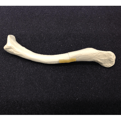 Sawbone Clavicle w/ Transverse Fracture